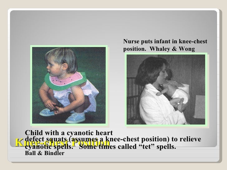 4 Congenital Heart Disease