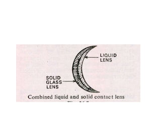 Contact-lenses.ppt