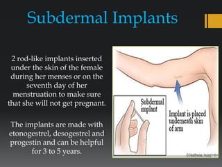 Contraception Methods | PPTX