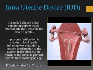 Contraception Methods | PPTX