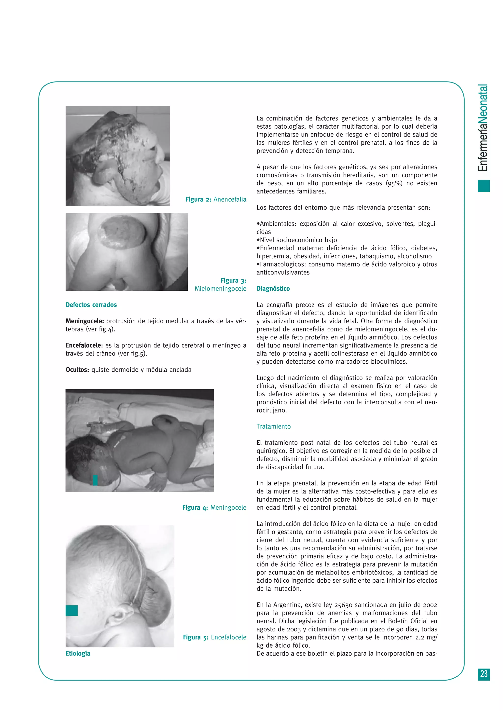 4 cuidados-en-recién-nacidos-con-defectos-del-tubo-neural | PDF