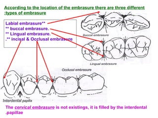 direct factors and their significeance in protection of periodontium | PPT
