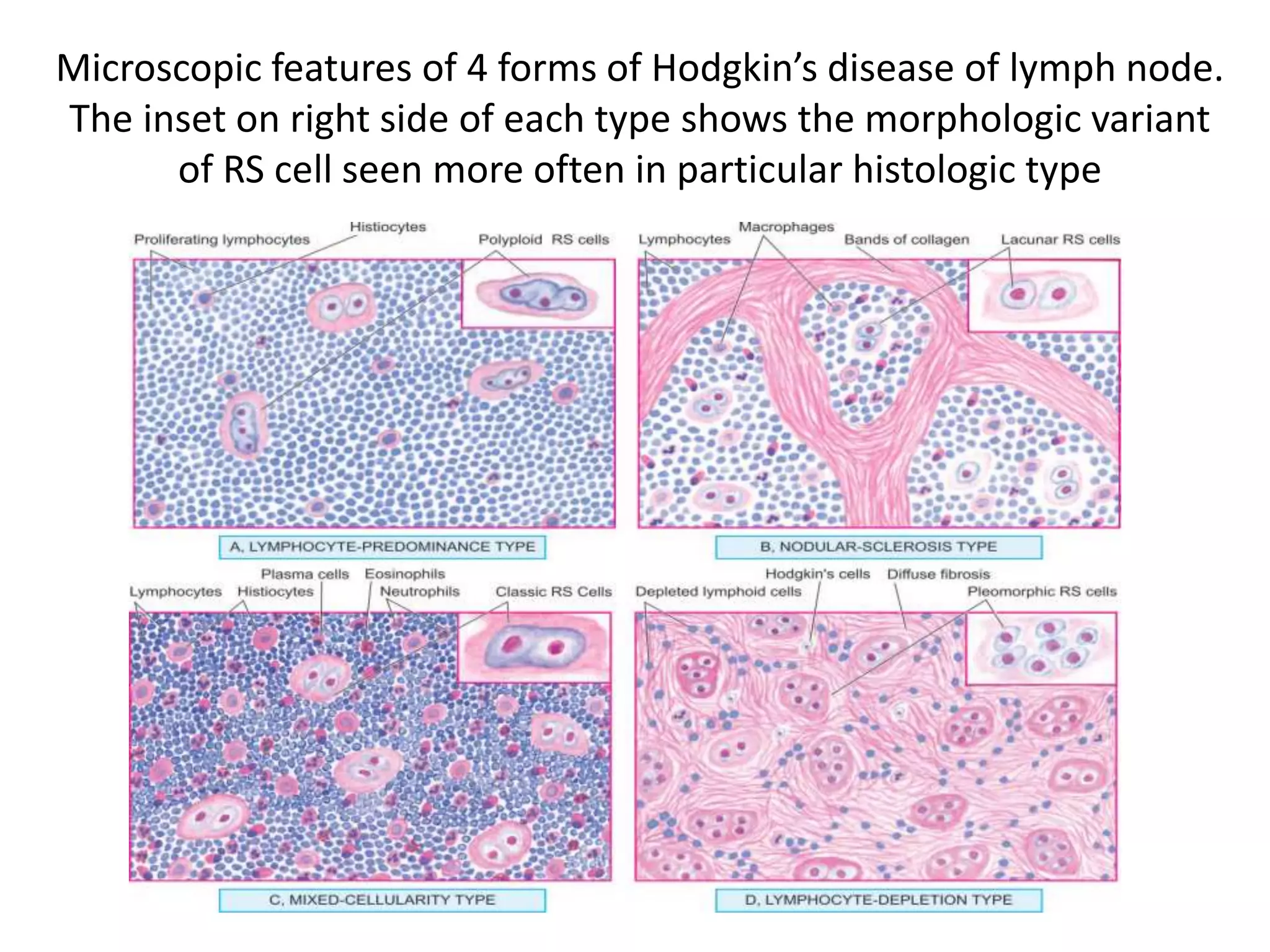 Diseases of white blood cells, lymph nodes, spleen, and thymus | PPTX