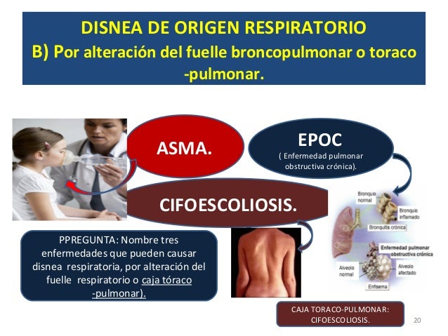 Fisiopatologia Disnea