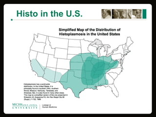 Histoplasmosis Map