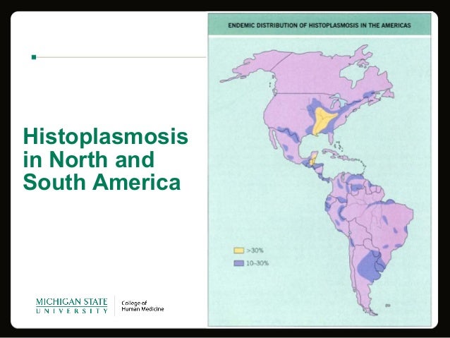 Overview of Histoplasmosis