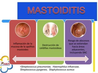 4. evaluar, clasificar y tratar al niño con problema de oído | PPTX