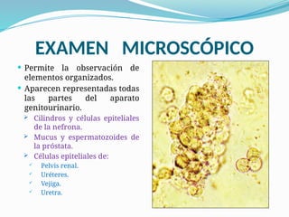 4 - EXAMEN FÍSICO, QUÍMICO Y MICROSCÓPICO DE LA ORINA.pptx
