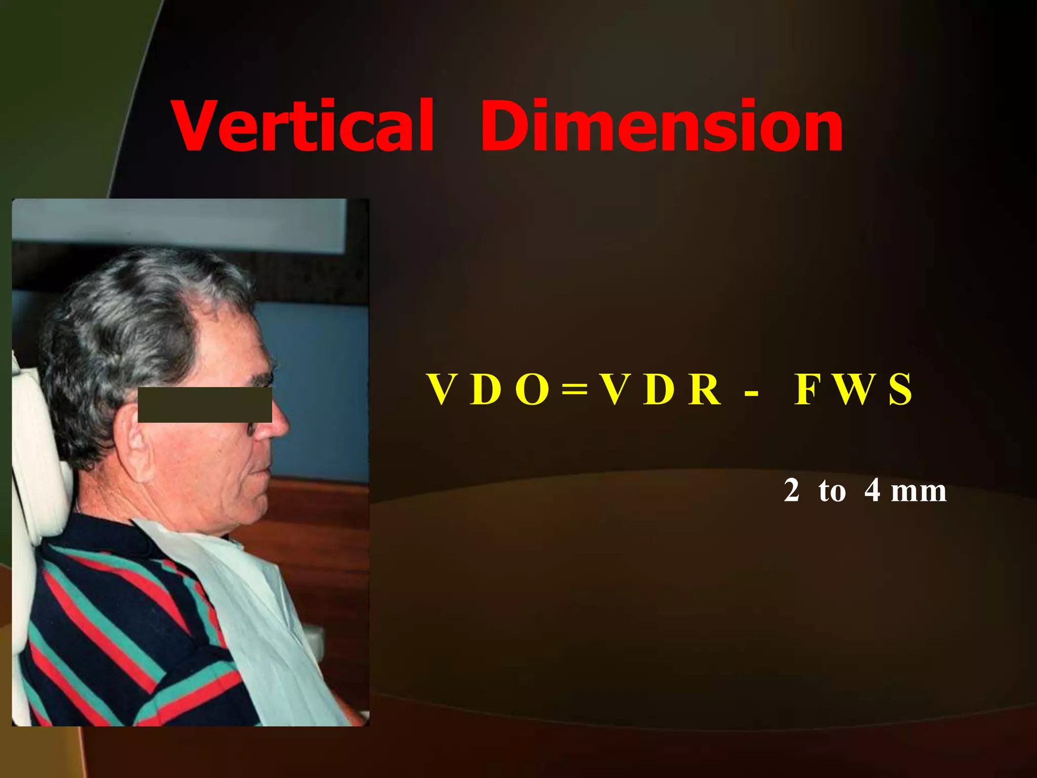 Clinical Steps for Complete Denture Construction 4- Steps of recording ...