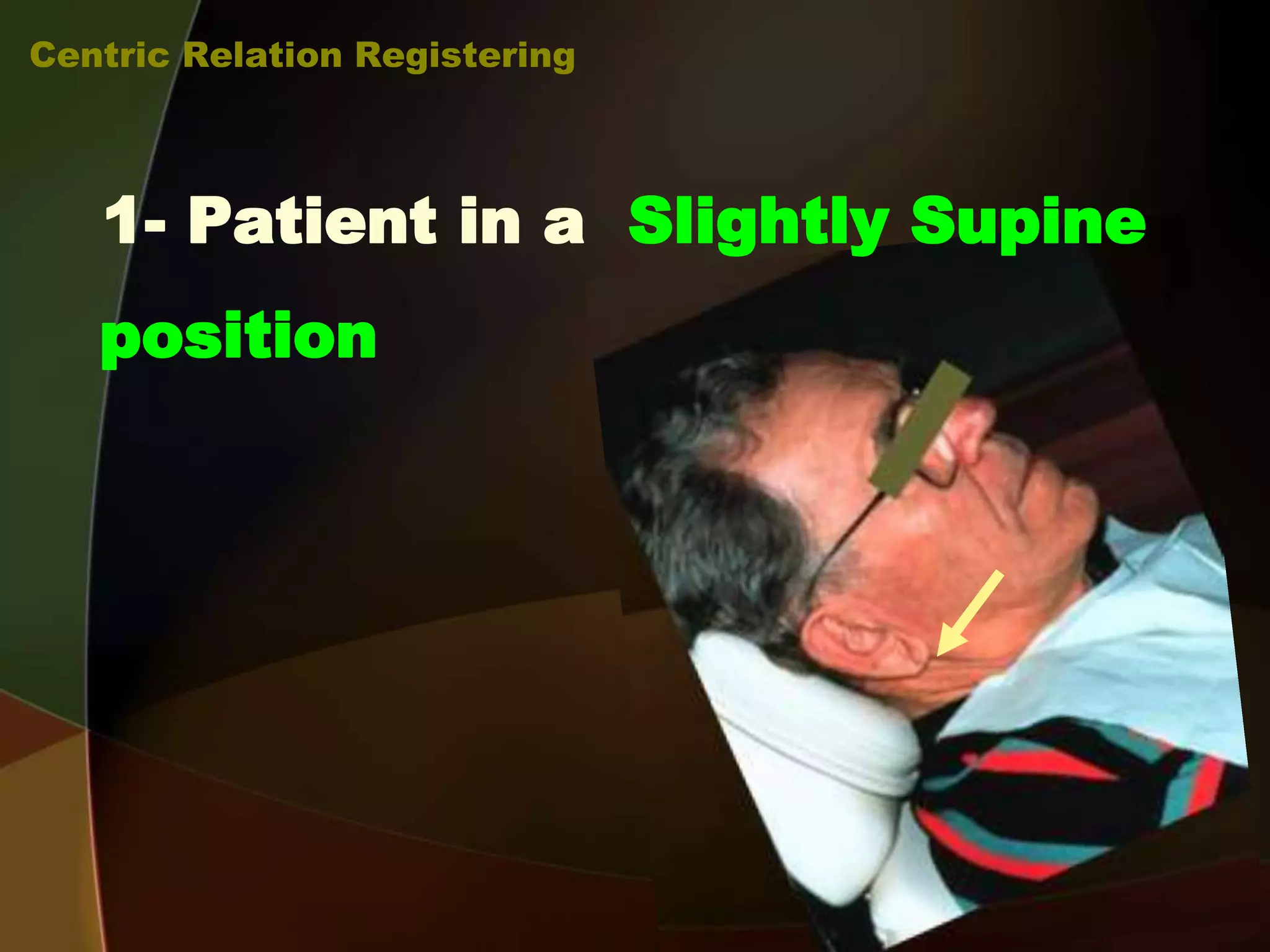 Clinical Steps for Complete Denture Construction 4- Steps of recording ...