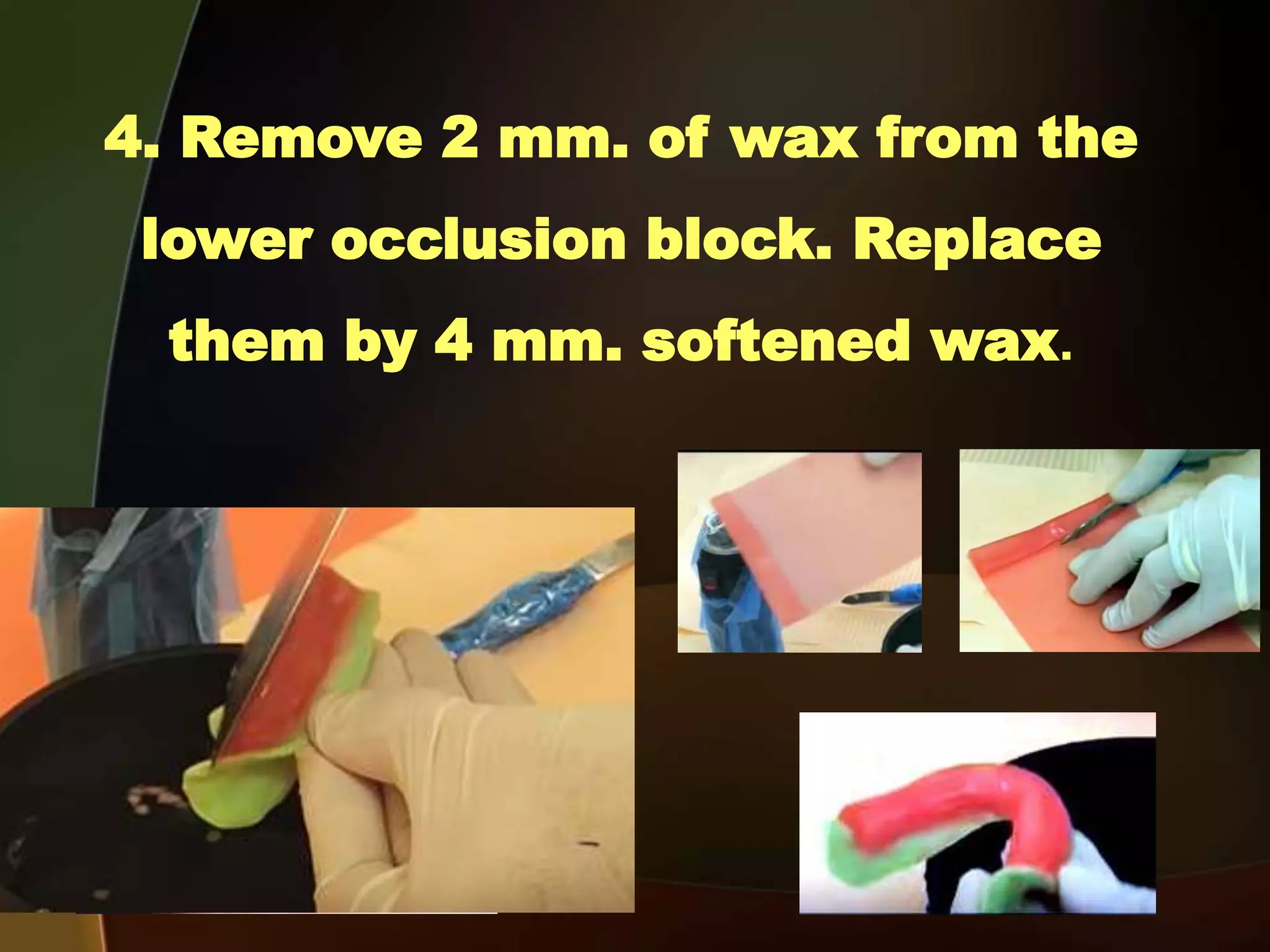 Clinical Steps for Complete Denture Construction 4- Steps of recording ...