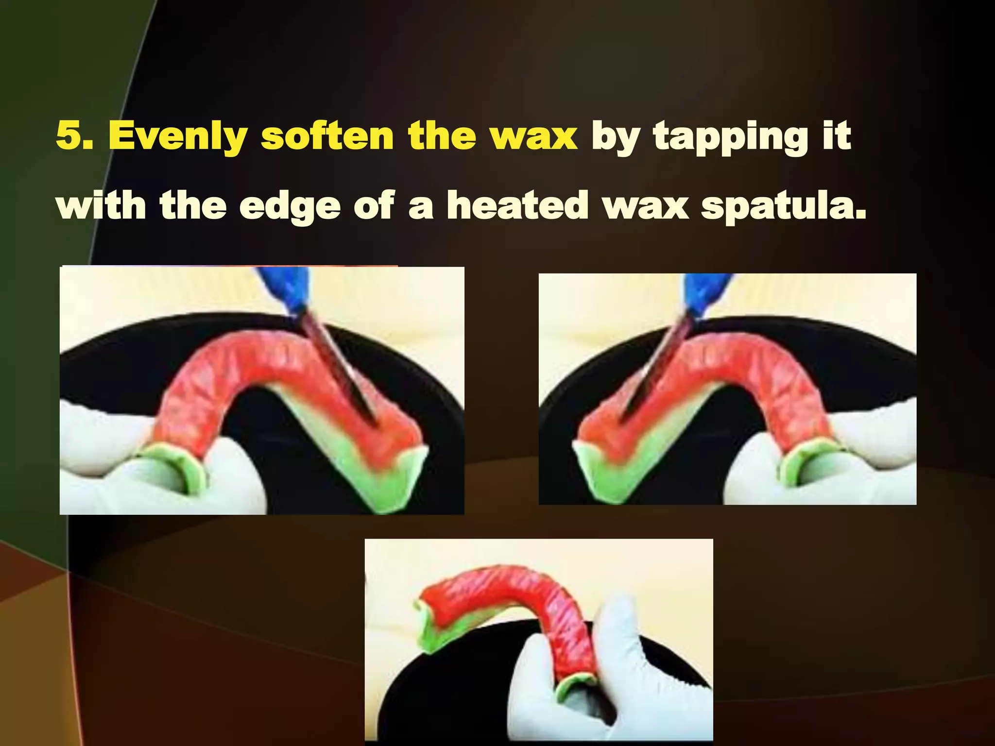 Clinical Steps for Complete Denture Construction 4- Steps of recording ...