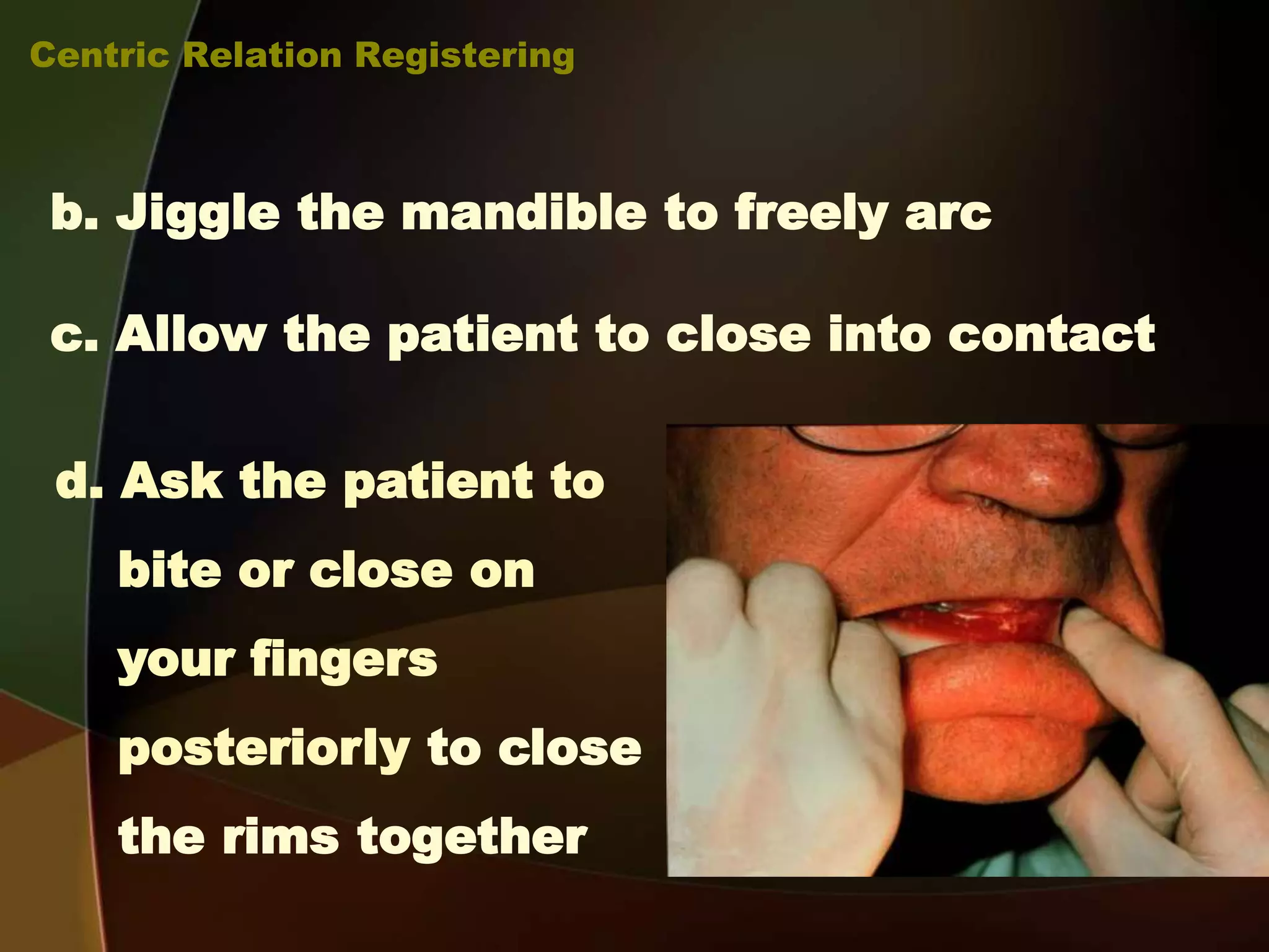 Clinical Steps for Complete Denture Construction 4- Steps of recording ...