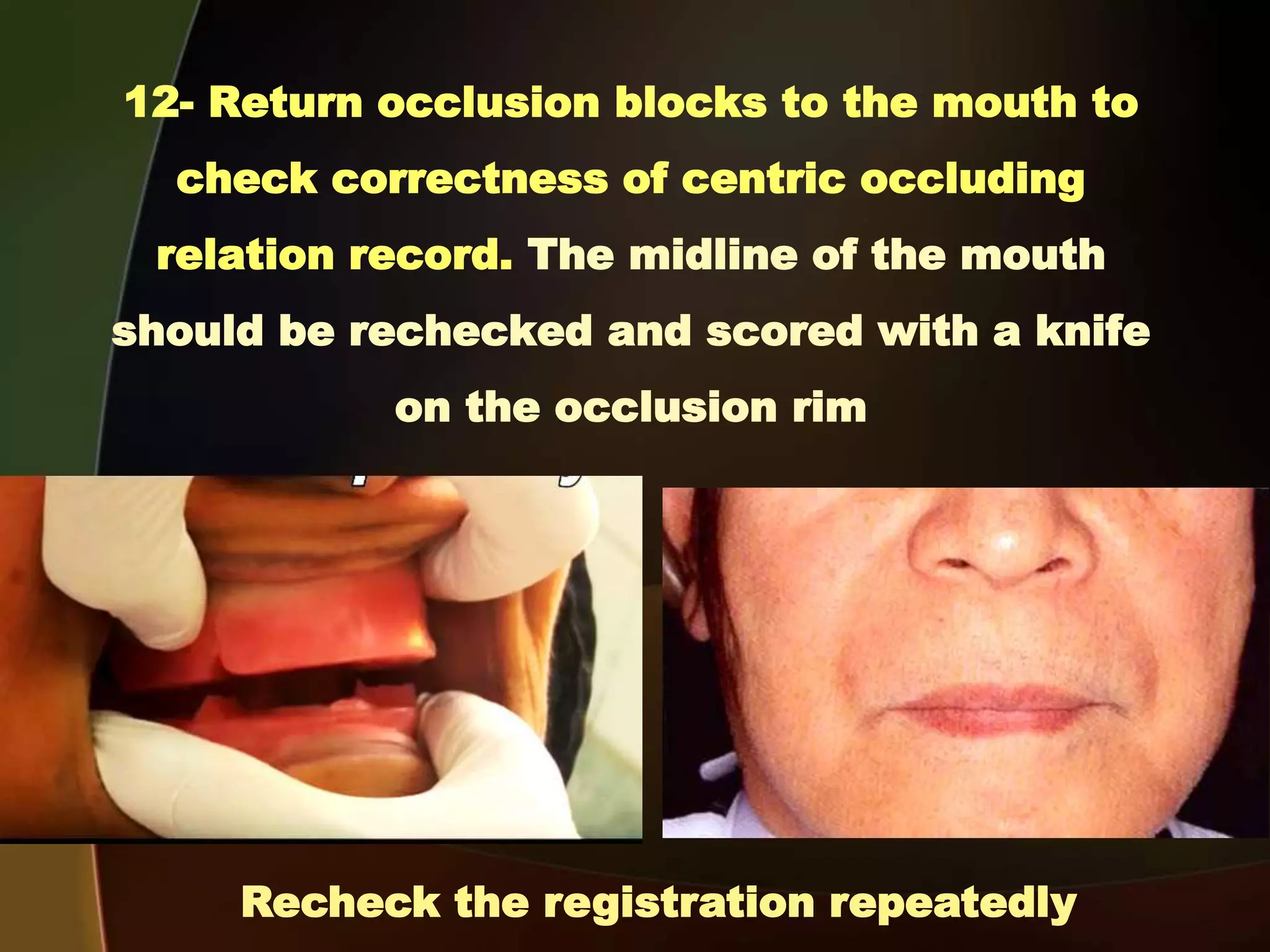 Clinical Steps for Complete Denture Construction 4- Steps of recording ...