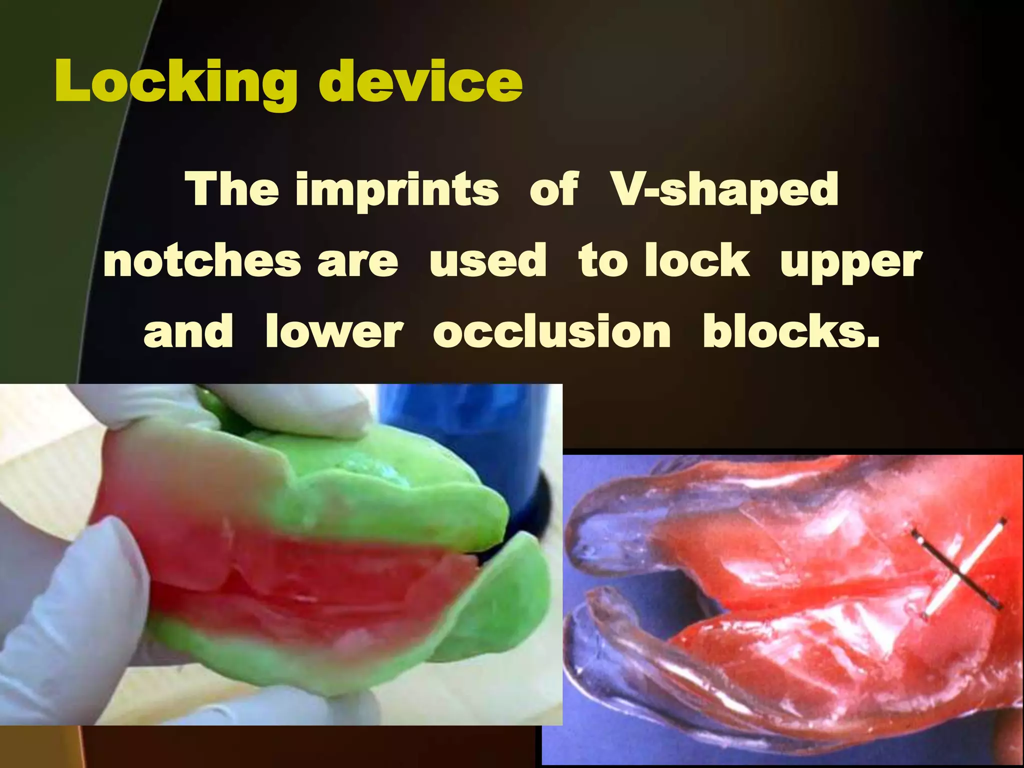 Clinical Steps for Complete Denture Construction 4- Steps of recording ...