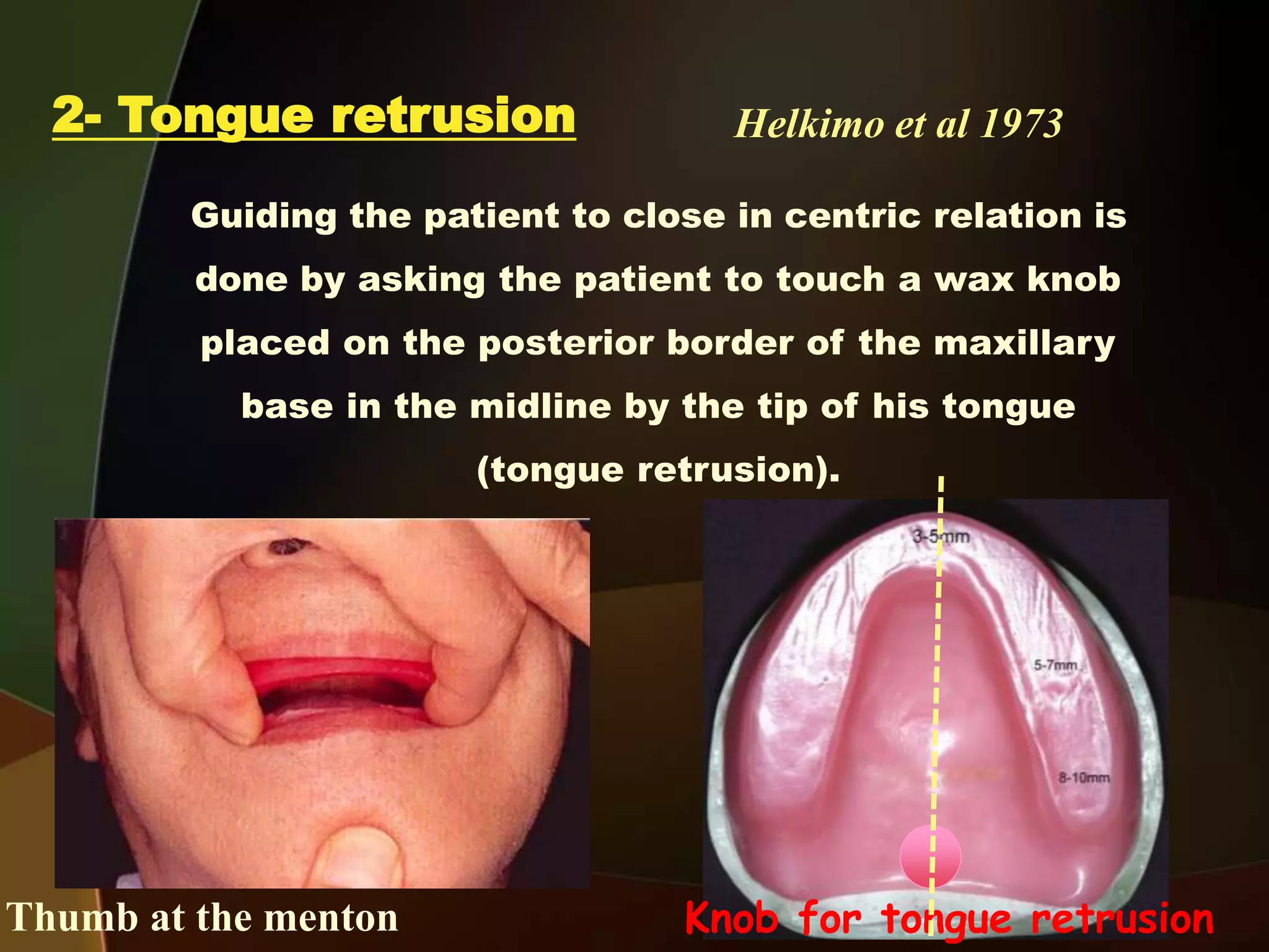 Clinical Steps for Complete Denture Construction 4- Steps of recording ...