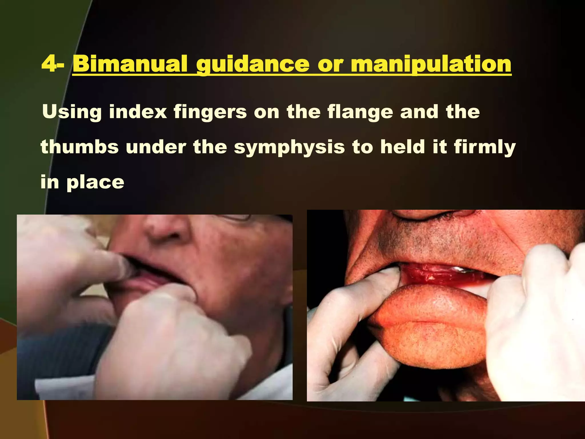 Clinical Steps for Complete Denture Construction 4- Steps of recording ...