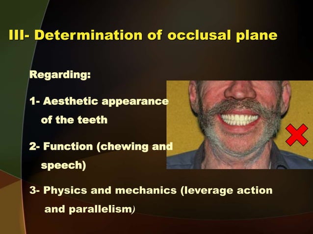 Clinical Steps for Complete Denture Construction 4- Steps of recording ...