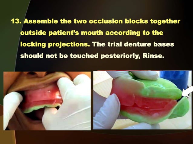 Clinical Steps for Complete Denture Construction 4- Steps of recording ...