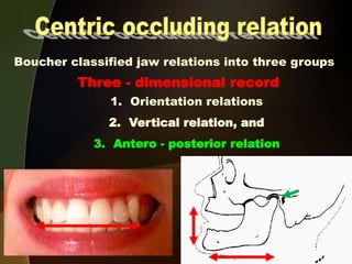Clinical Steps for Complete Denture Construction 4- Steps of recording ...