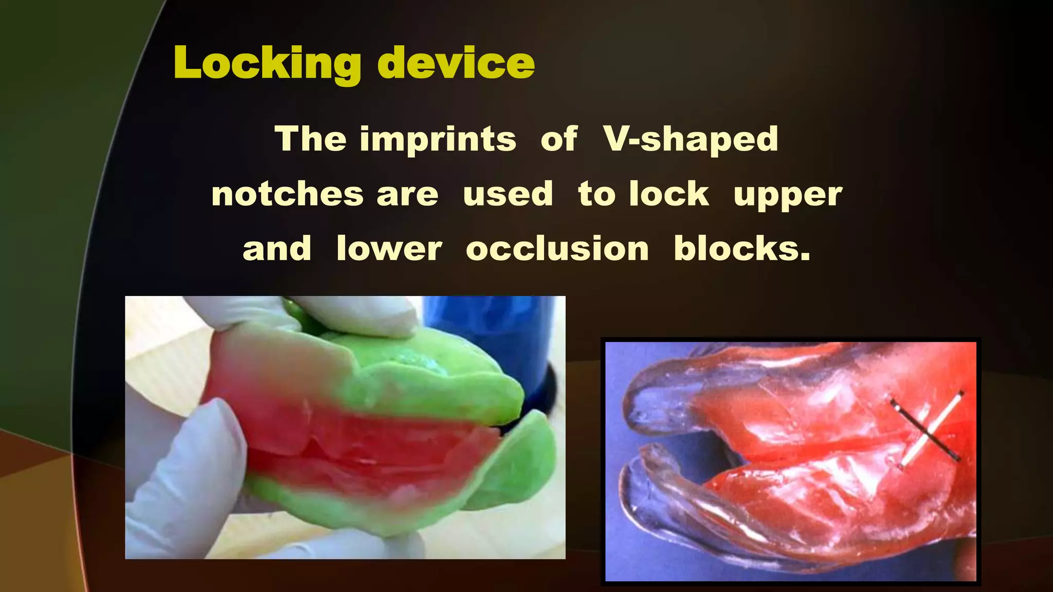 Complete Denture 4- Maxillo-mandibular Relation Records d- Centric ...