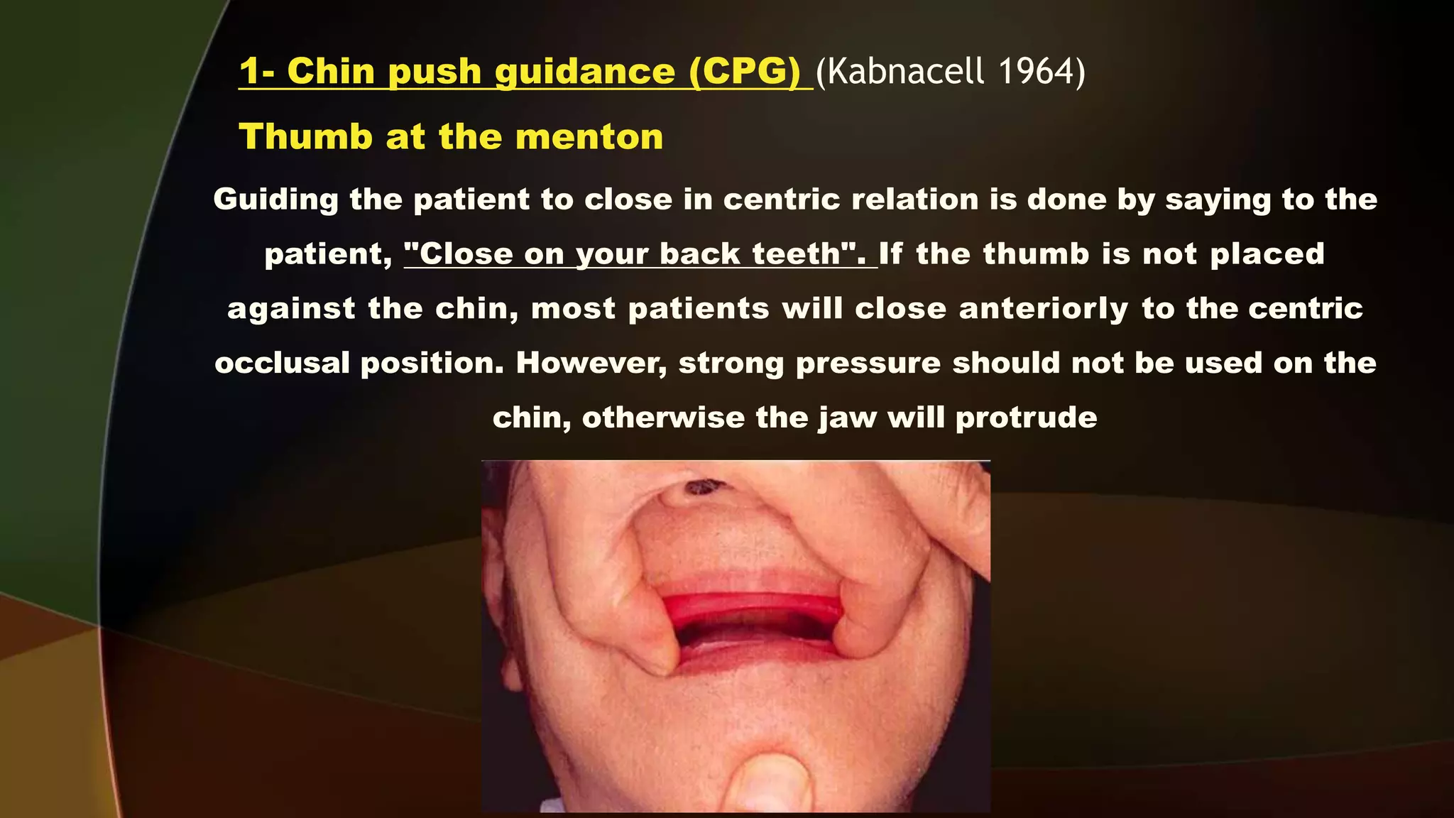 Complete Denture 4- Maxillo-mandibular Relation Records d- Centric ...