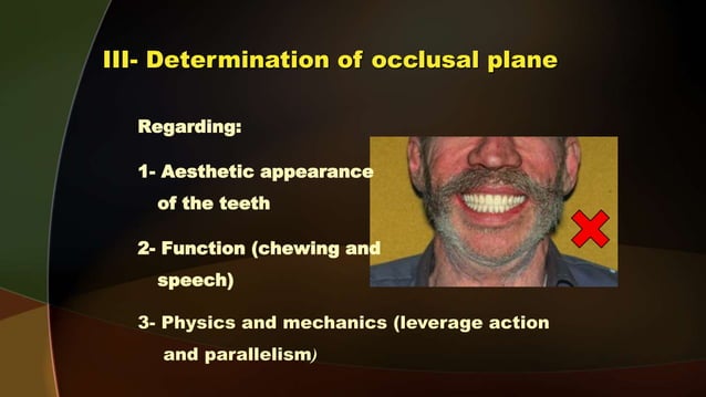 Complete Denture 4- Maxillo-mandibular Relation Records d- Centric ...