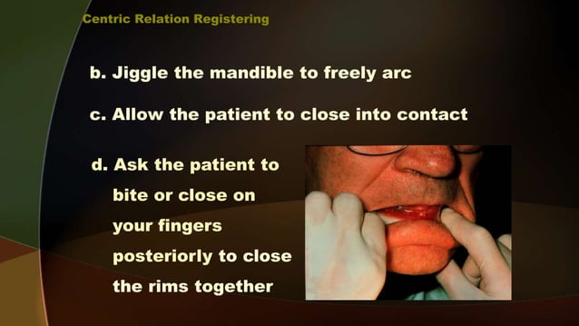 Complete Denture 4- Maxillo-mandibular Relation Records d- Centric ...