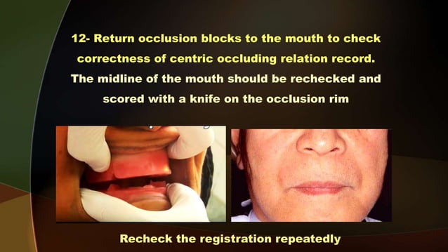 Complete Denture 4- Maxillo-mandibular Relation Records d- Centric ...