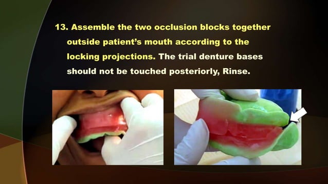 Complete Denture 4- Maxillo-mandibular Relation Records d- Centric ...