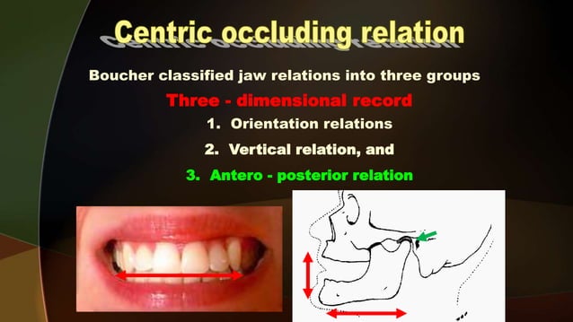 Complete Denture 4- Maxillo-mandibular Relation Records d- Centric ...