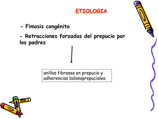 Fimosis-y-Circuncision | PPT