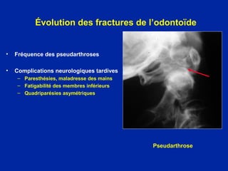 Radiographie De Fracture Odontoïde