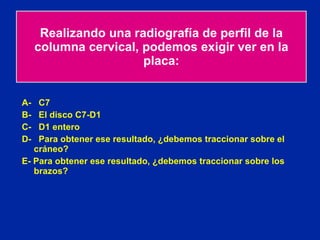 4 fracturas cervicales | PPT