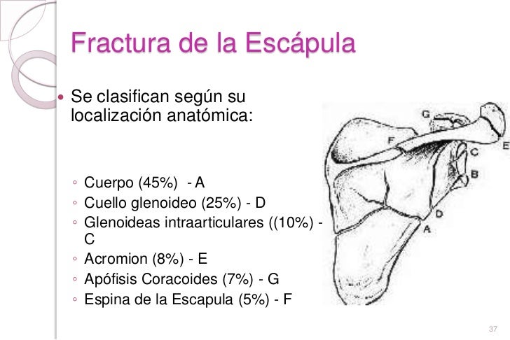 4.fracturas de clavicula, escapula, luxaciones ac.