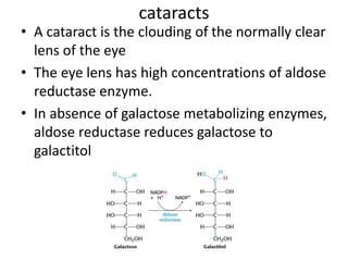 4 - GALACTOSE METABOLISM.pptx22222222222 | PPT