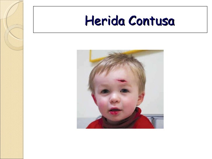 4.heridas
