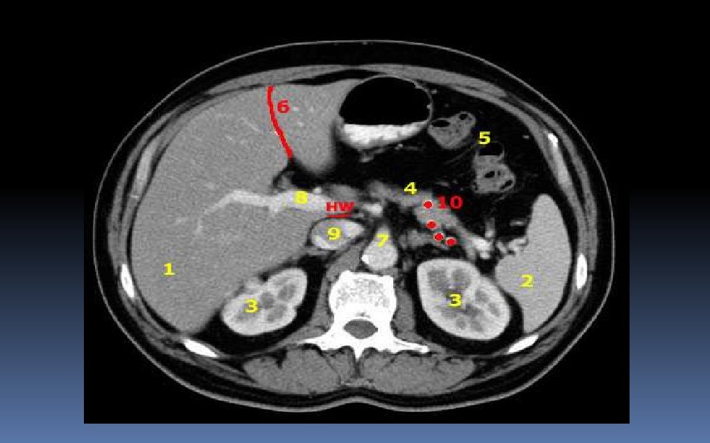 4. imagenología de abdomen clase