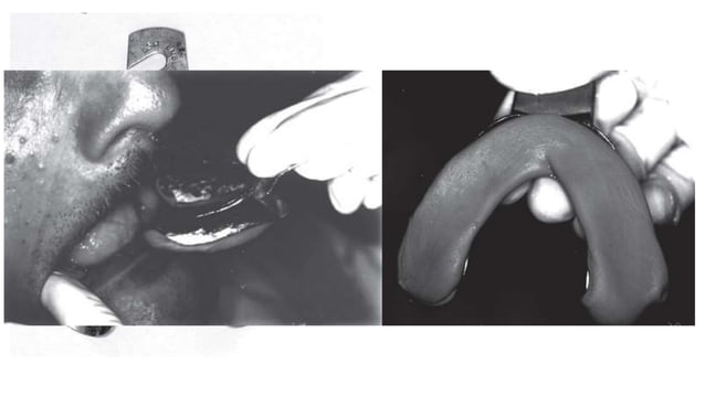 Impression materials | PPT