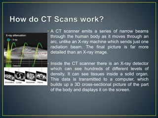 Intro to CT scan machine | PPTX