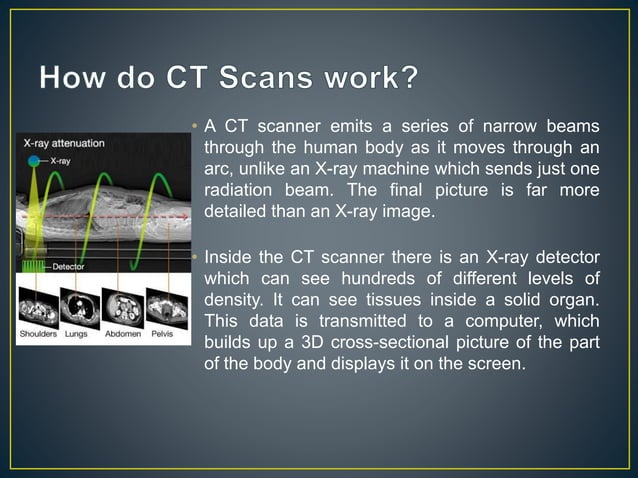 Intro to CT scan machine | PPTX | Medical Tests | Medical Health