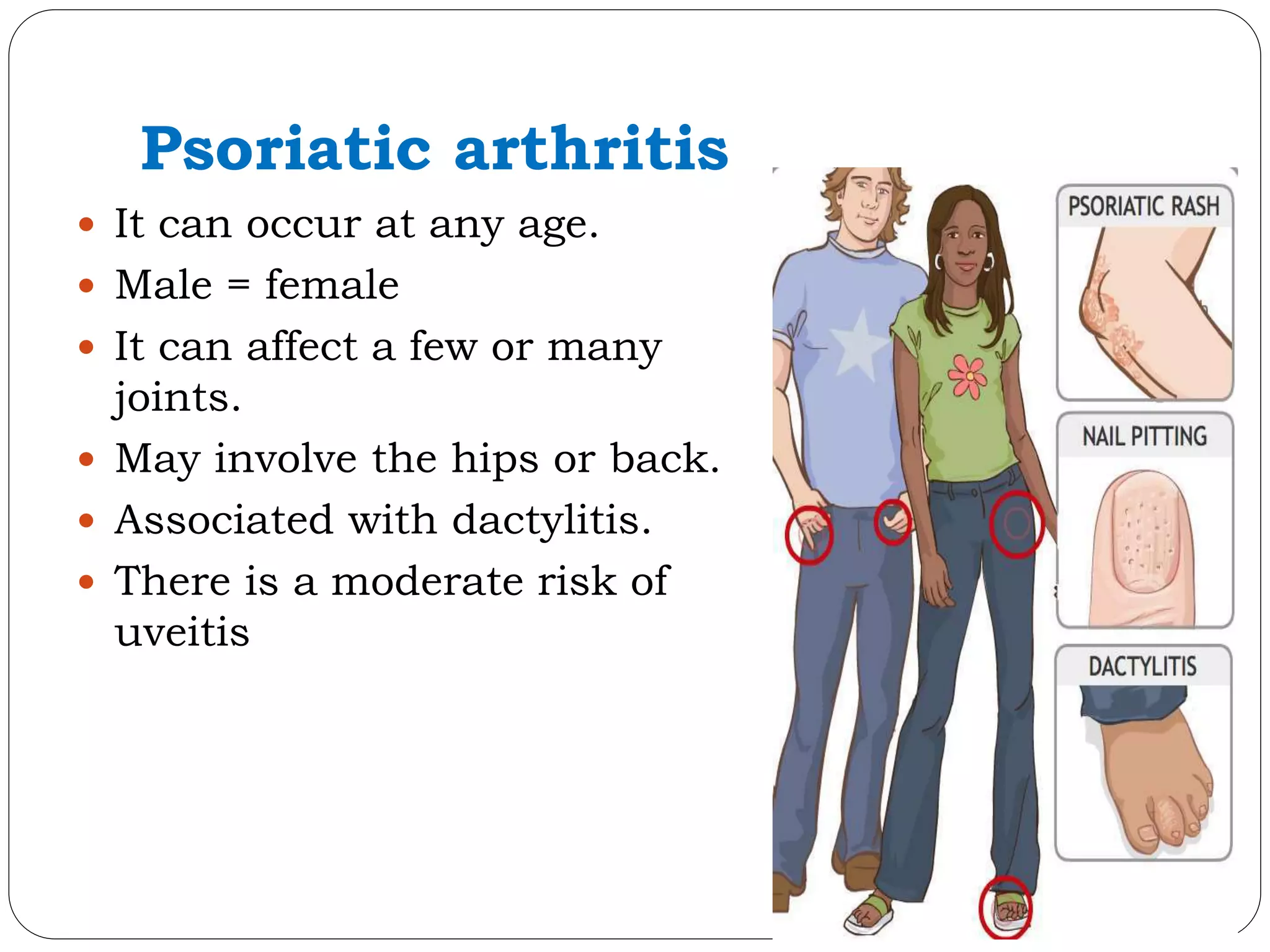 Juvenile idiopathic arthritis (JIA) | PPTX