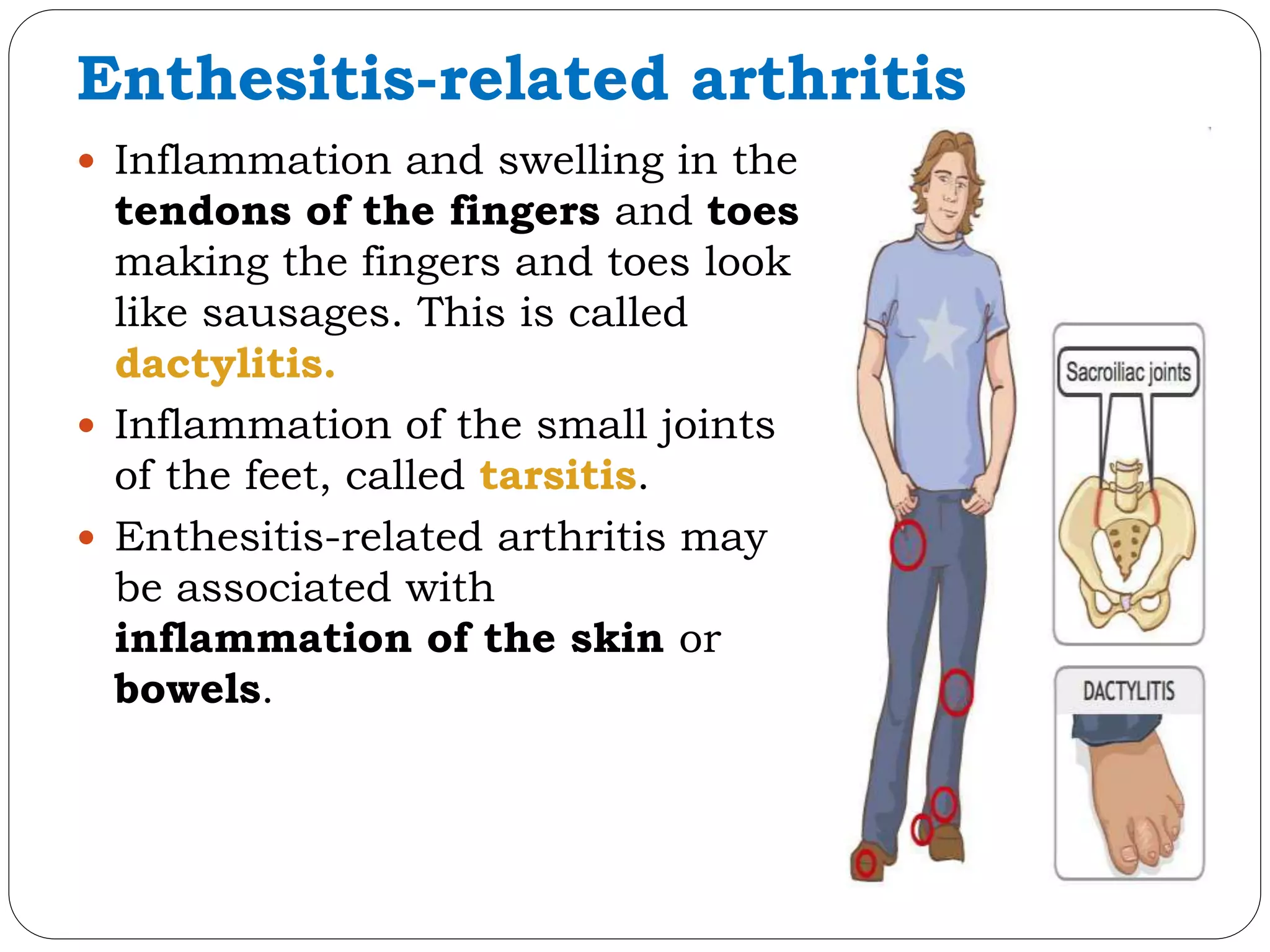 Juvenile idiopathic arthritis (JIA) | PPTX