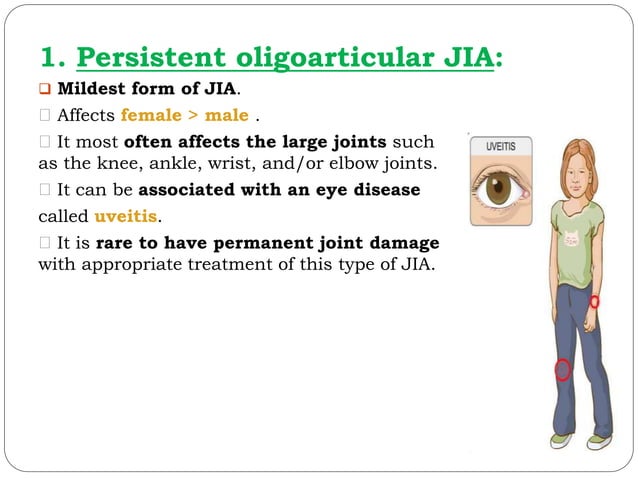 Juvenile idiopathic arthritis (JIA) | PPTX