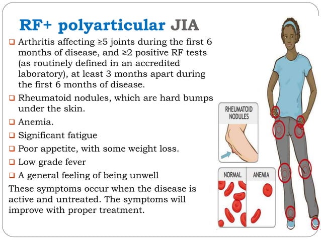 Juvenile idiopathic arthritis (JIA) | PPTX