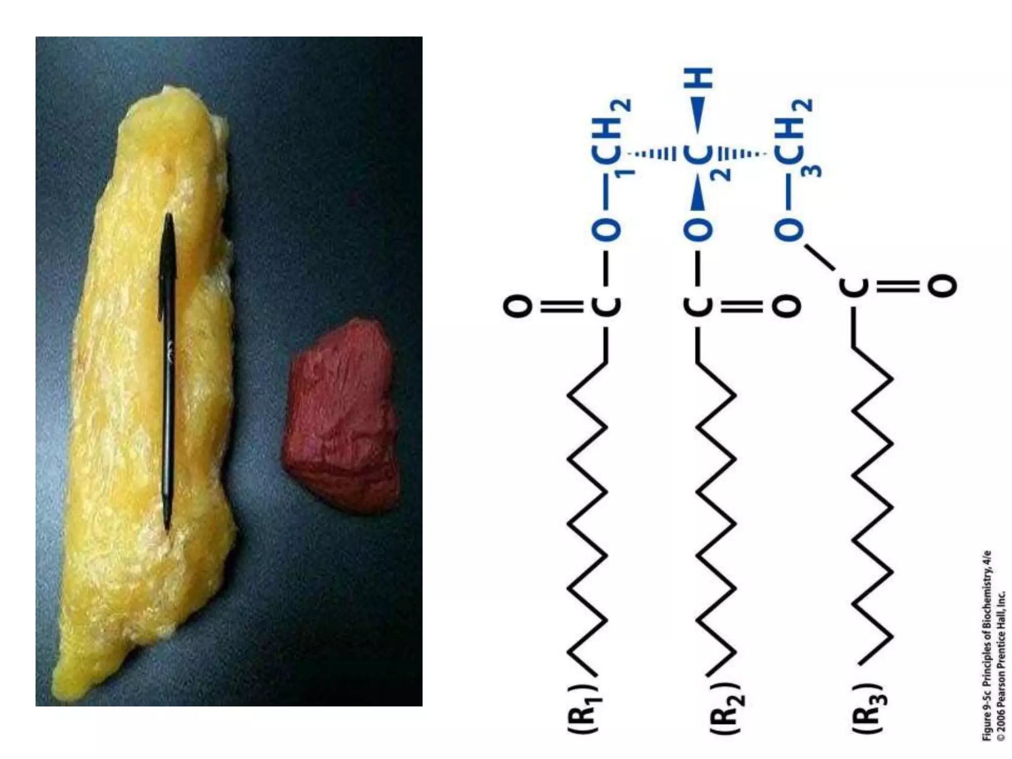 4- lipids (2).pptx