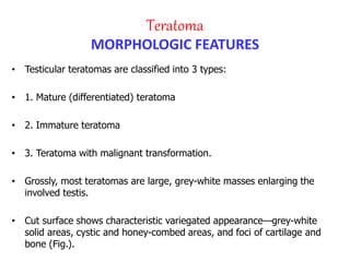 TESTICULAR TUMOURS | PPTX