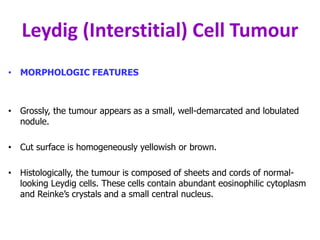MALE GENITAL TRACT – TESTICULAR TUMORS | PPTX