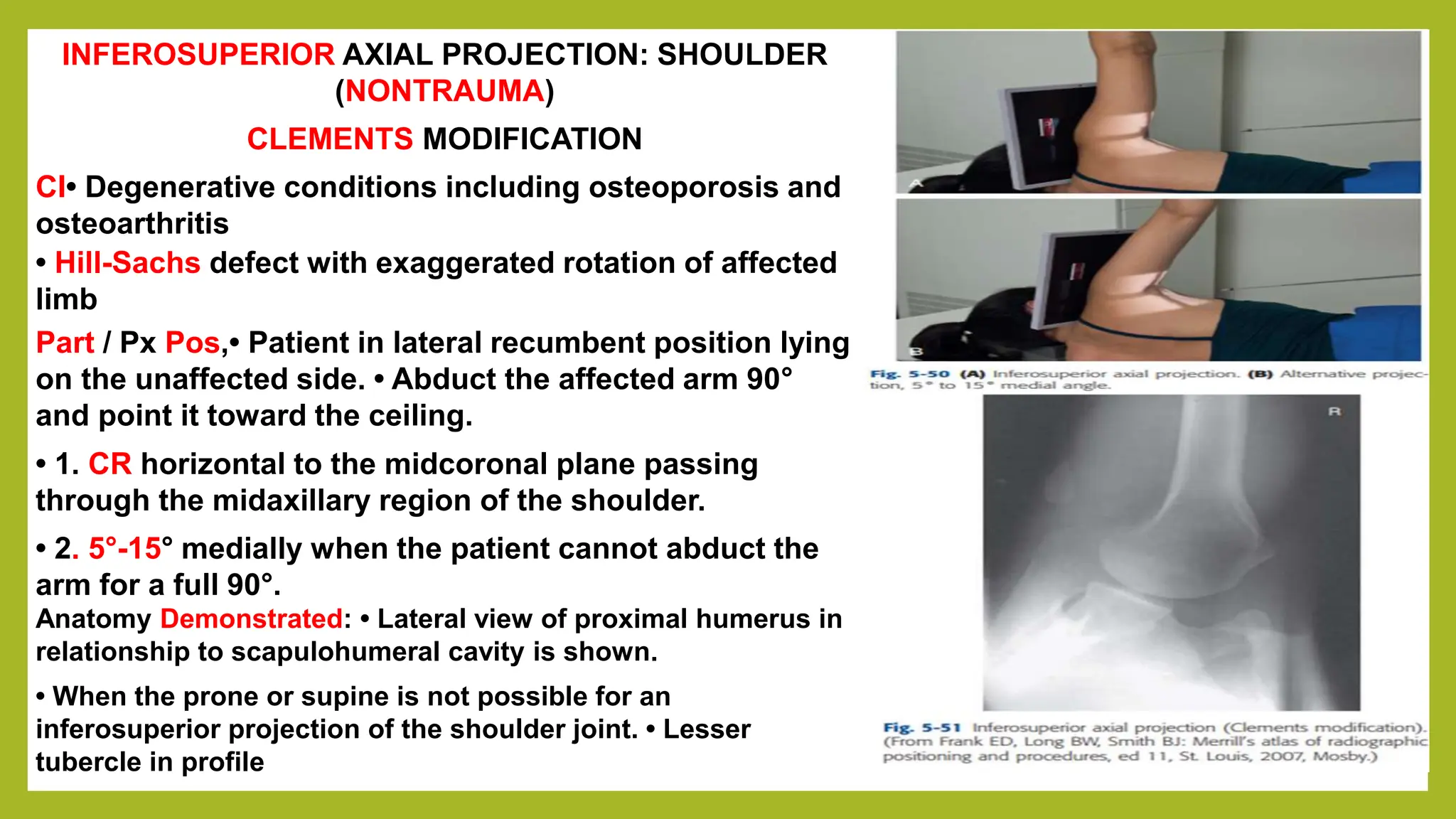 (4-M) 301 - A Shoulder to Clavicle.pptx