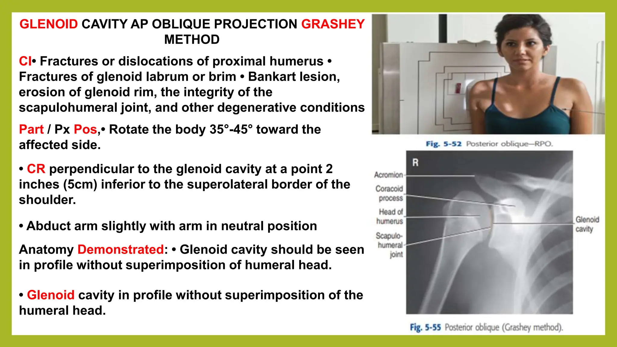 (4-M) 301 - A Shoulder to Clavicle.pptx